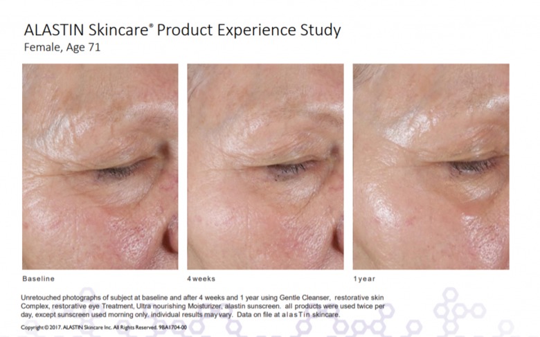 ALASTIN Skincare - Anti-Aging Product Range, Price & Reviews